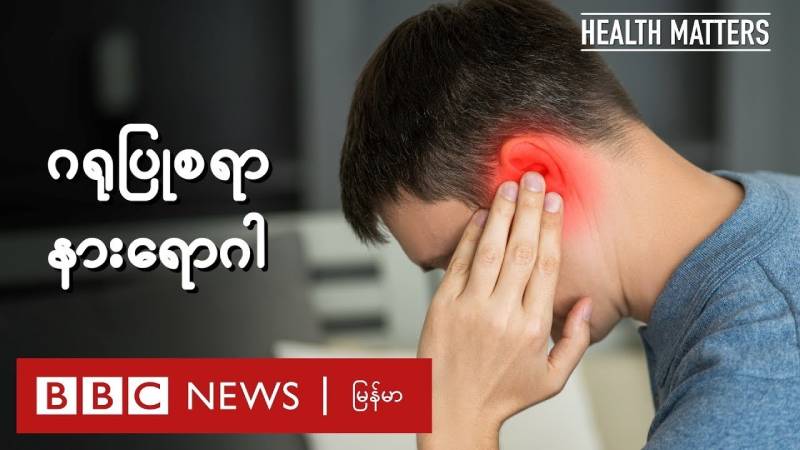 ဂရုပြုစရာ နားရောဂါ Bbc News မြန်မာ Bur Mizzima Com